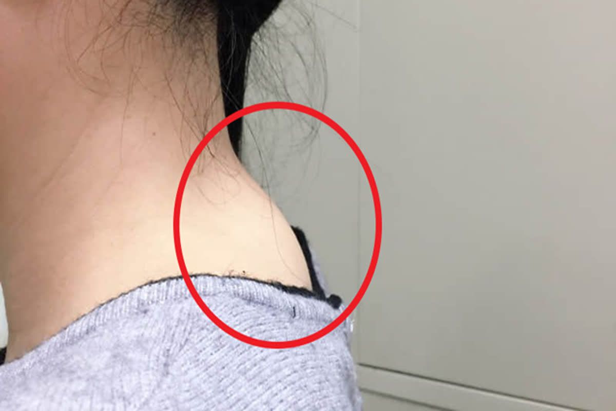 If You Spend Over 3 Hours a Day on Computers or Phones – Suspect THIS ...