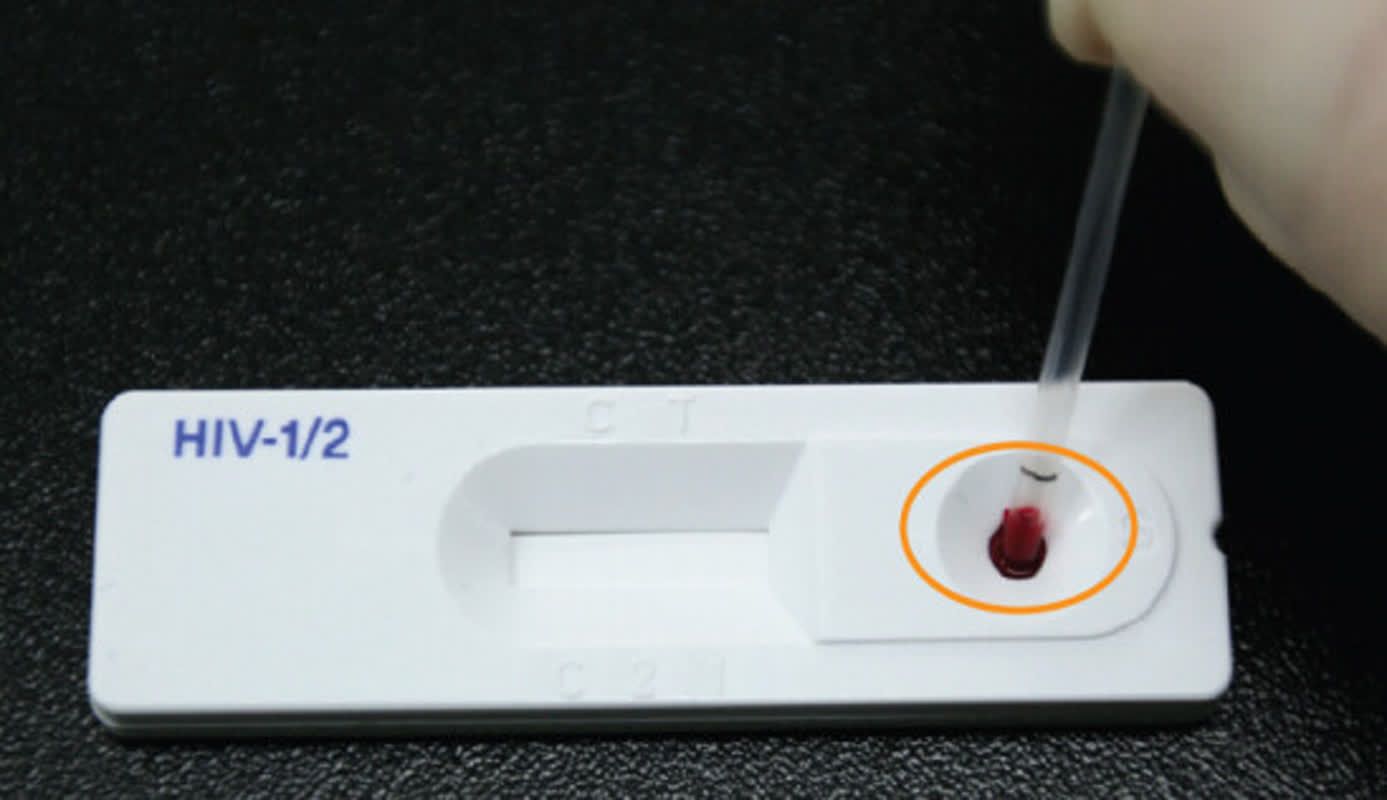 Seoul City Offers Anonymous HIV Testing for Public Health