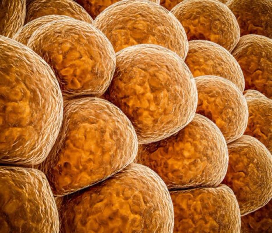 Size Matters: How Large Fat Cells Can Help You Lose Weight