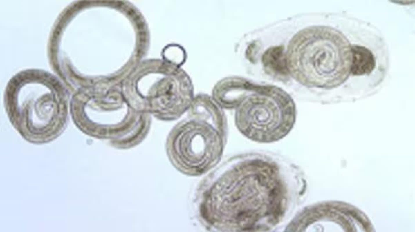 Bear Meat Warning: Family Suffers Rare Parasite Infection After BBQ