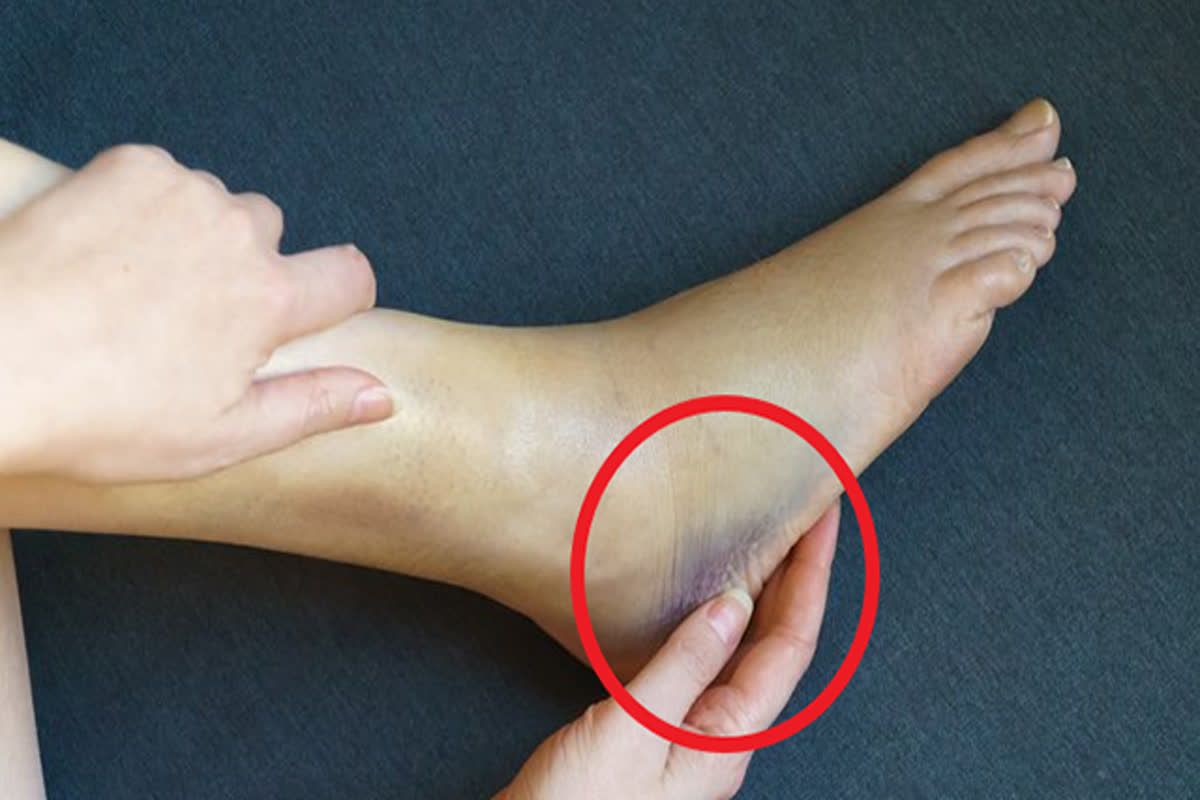 Frozen Fingers? and Chilly Toes? 10 Life Hacks to Beat Cold Extremities ...