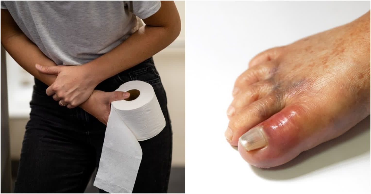 Too Much Protein Can Hurt You: 3 Dangerous Side Effects You Didn’t See ...