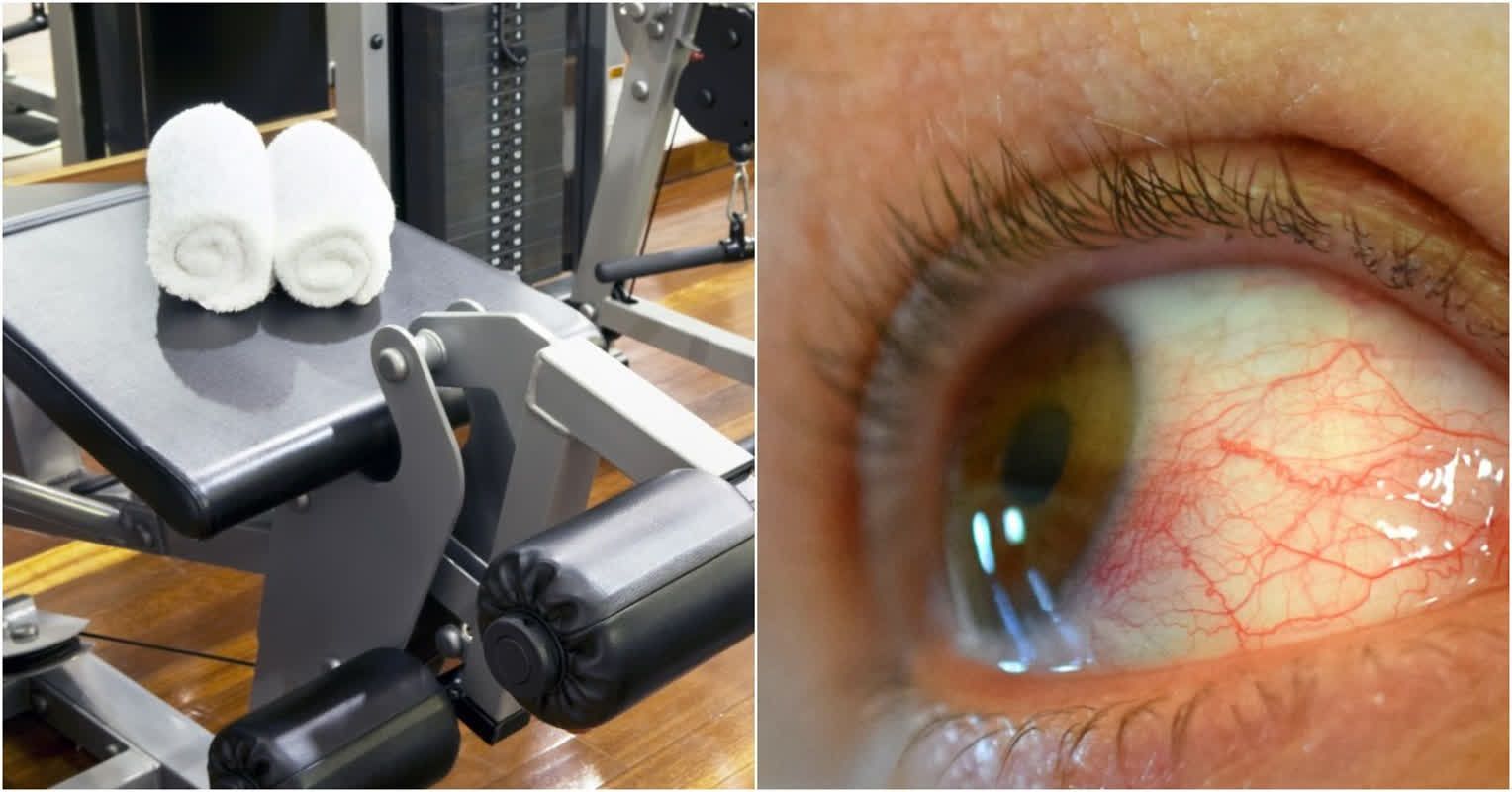 Doctor Warns: Using a Sweat-Sogged Towel at the Gym Could Expose You to ...