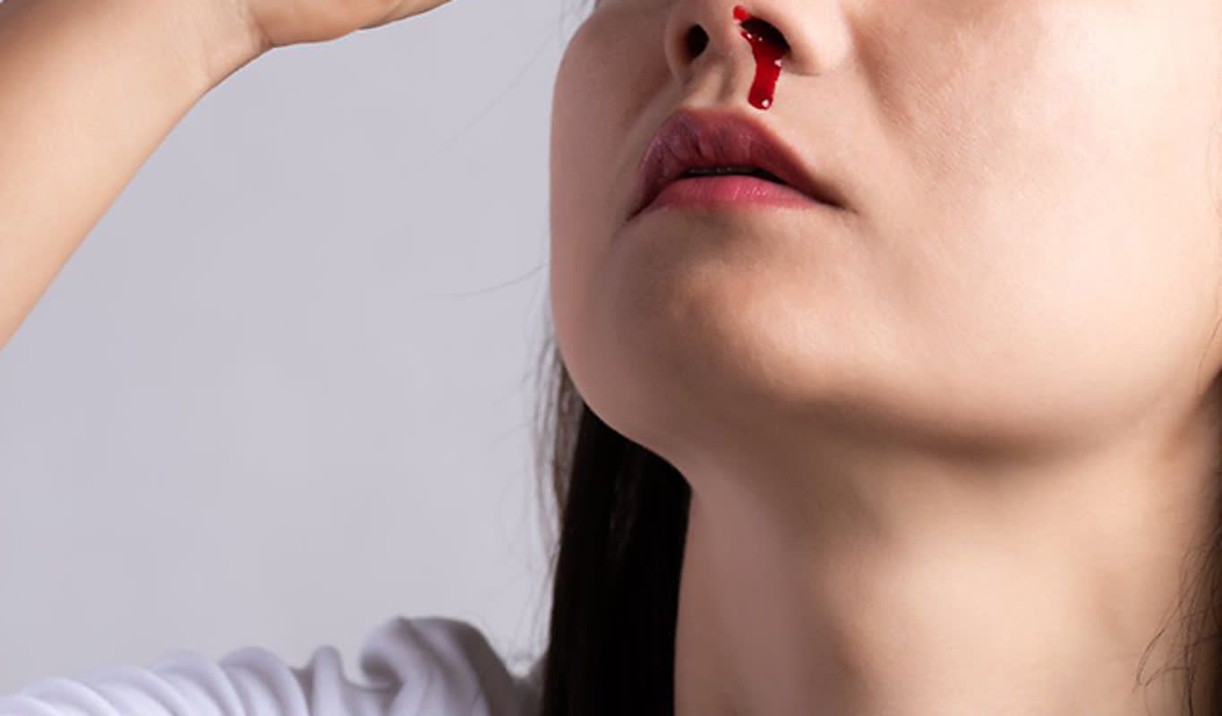 Dry Air and Nosebleeds: How Winter's Chill Could Be to Blame
