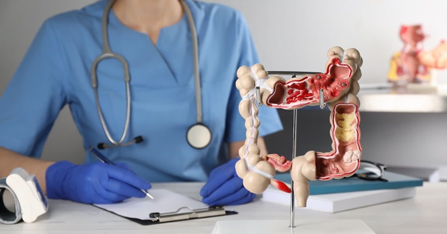 Dark Red vs. Bright Red: How to Spot Colon Cancer Early