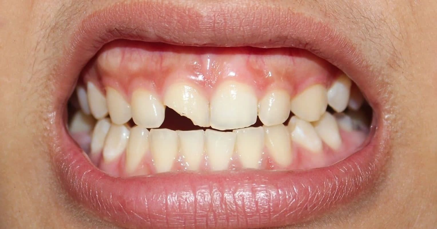 Real Teeth, Grown in a Lab? Scientists Say It’s Closer Than You Think